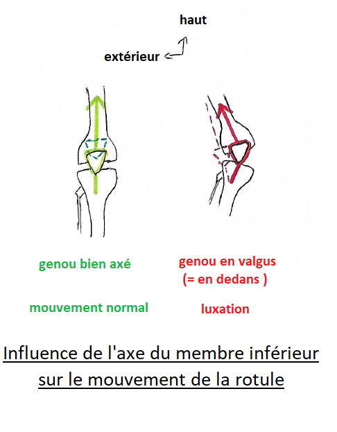 Luxation et sub luxation de la rotule