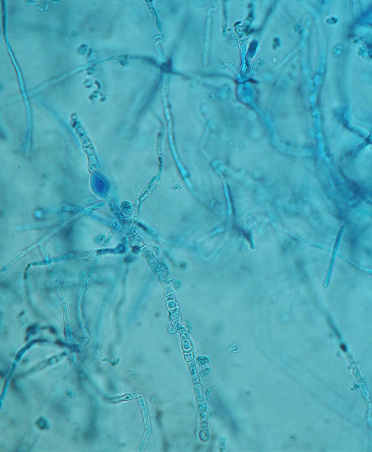 ATLAS MICOLOGIA: TRICHOPHYTON VERRUCOSUM