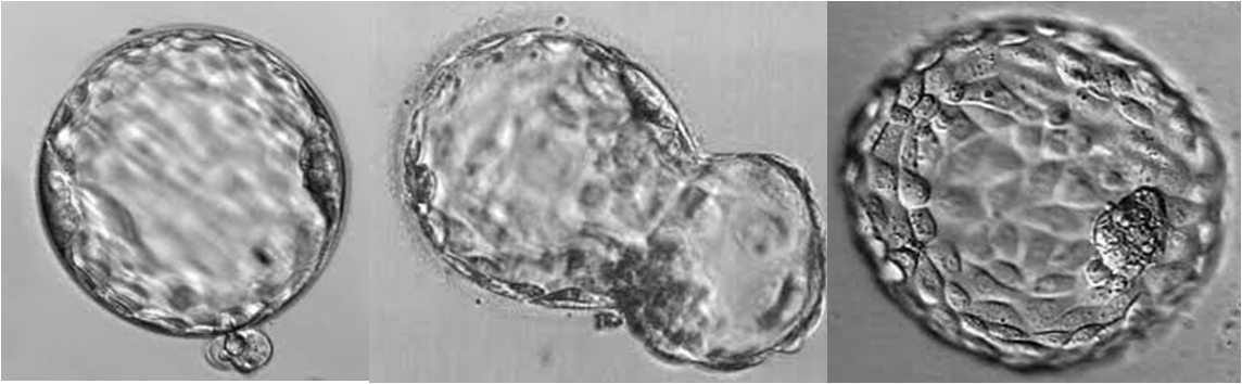 To make choosing embryo easier - Pre-implantation genetic screening ...