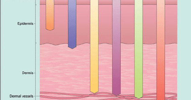 The Different Types of Laser Hair Removal Machines