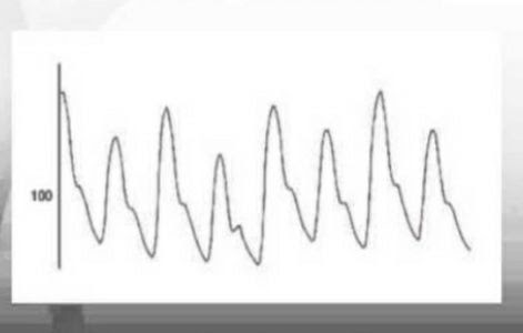 PULSE - HOW TO MEASUREMENT