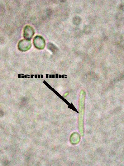 Fungal Structures and Mycology Terminologies Essential for ...