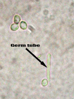 Fungal Structures and Mycology Terminologies Essential for ...
