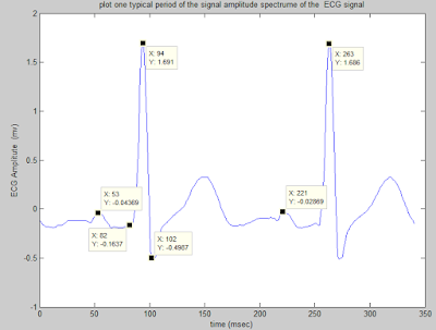 Biomedical Signal and Image Processing projects using Matlab and ...