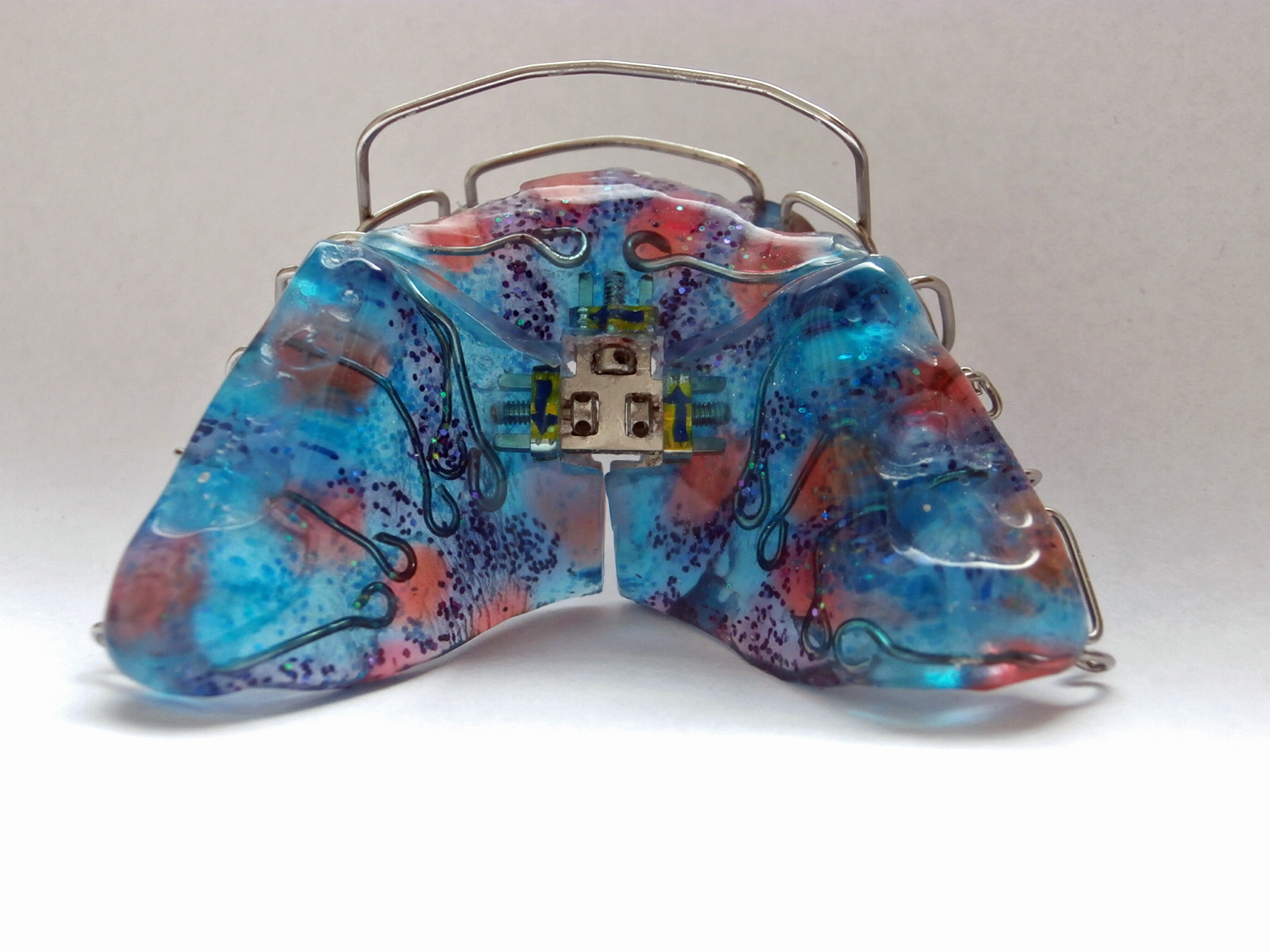 Aparaty ortodontyczne: 2015