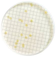 Microbiology Solutions: What is the difference between Bioburden and ...
