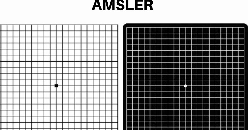 El test de la rejilla de Amsler