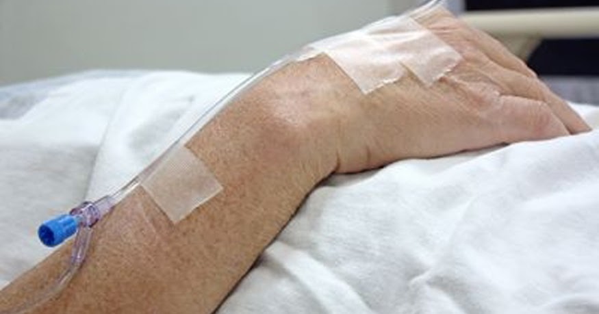 Skin Cancer Deaths Higher in Men Than in Women