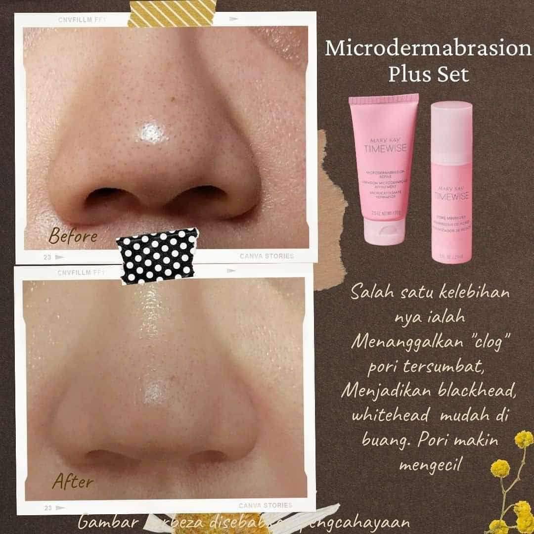 4 sebab kenapa perlu exfoliate muka setiap minggu. Kalau tak diamalkan ...