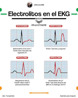 ZONA DE SALUD DE OFRA: @ELDoctorEME. Electrolitos en el ekg.
