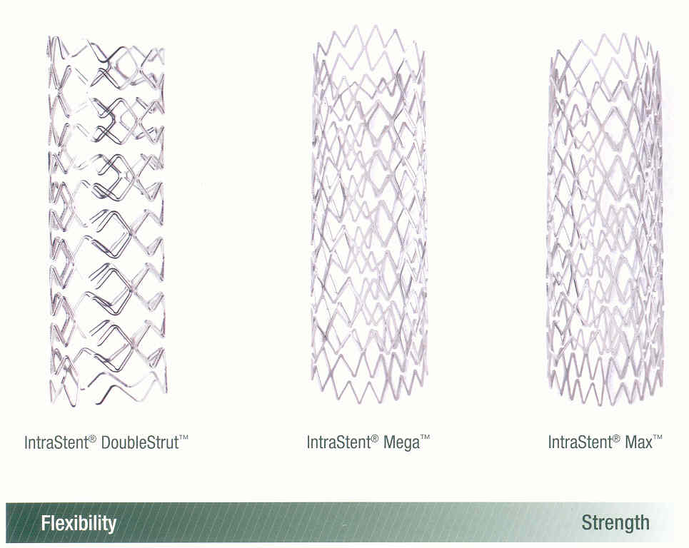 Pedi cardiology: Cath: Stents - Intrastent LD