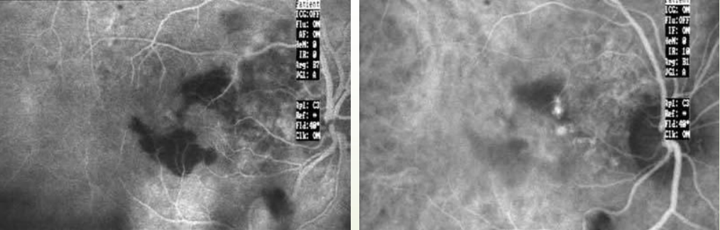 Cátedra N° 07 - Fundamento y fases del angiograma