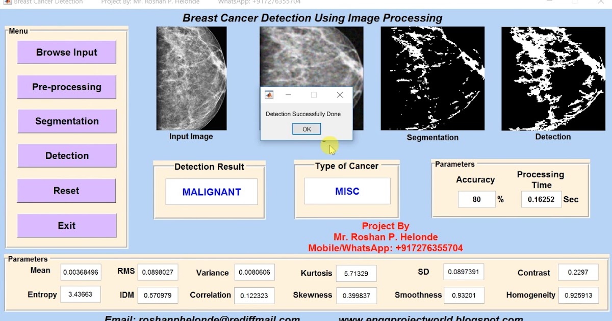 Types Of Breast Cancer Detection Using Matlab Source Code ~ Engineering