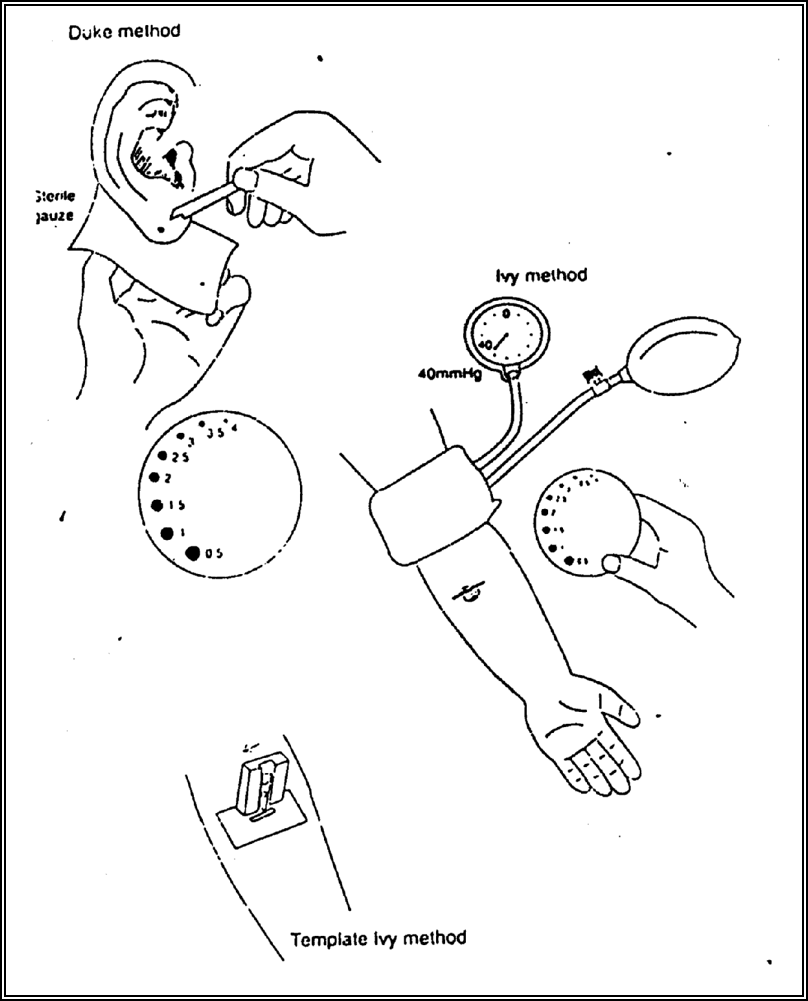 Pemeriksaan Bleeding Time (Waktu Perdarahan) Metode Duke dan Ivy