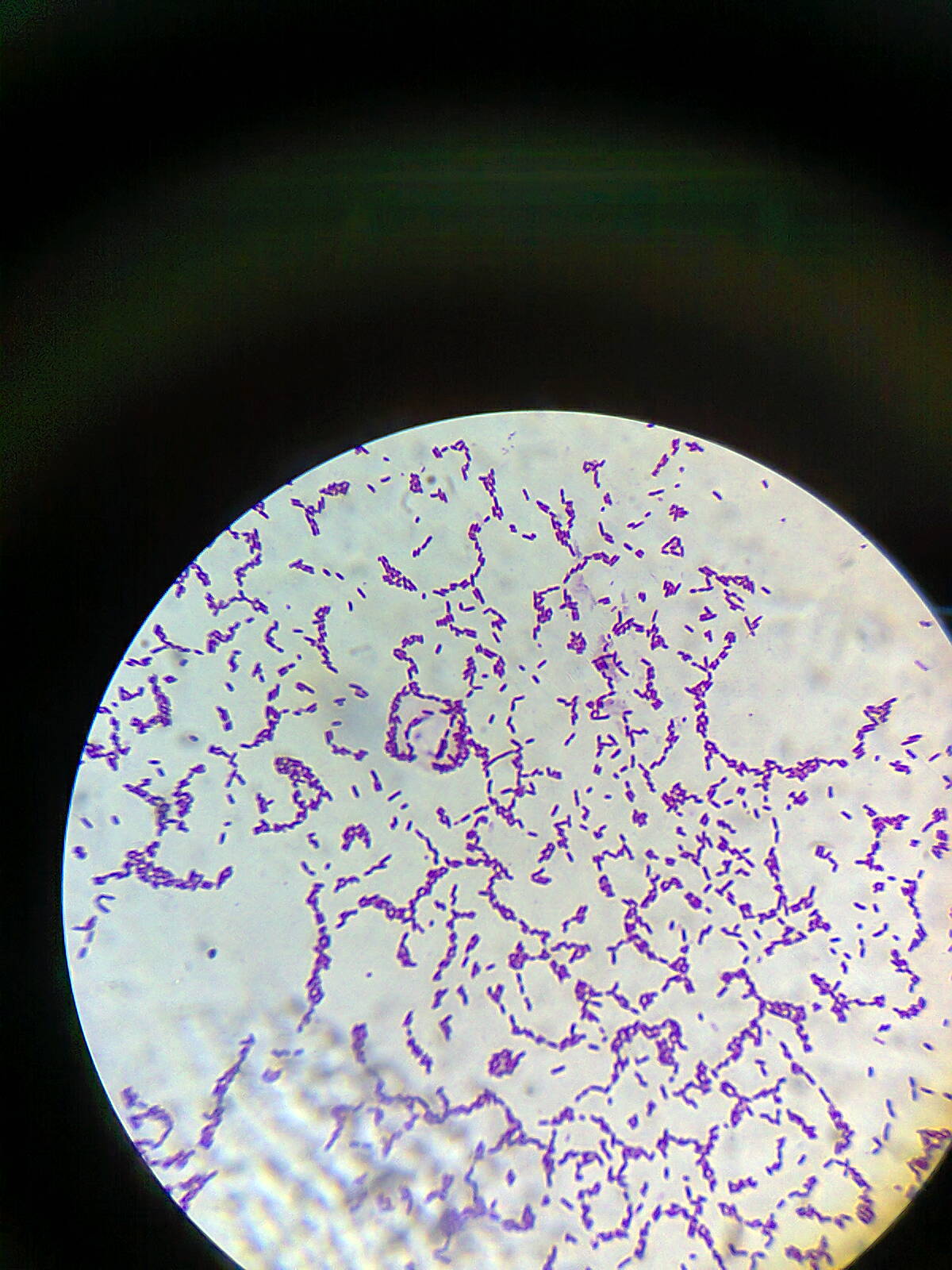 Teenoz Health Analyst: Gambar Hasil Identifikasi Klebsiella