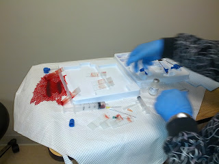 Life Interrupted: Official Results, Tentative Treatment Plan & Bone ...