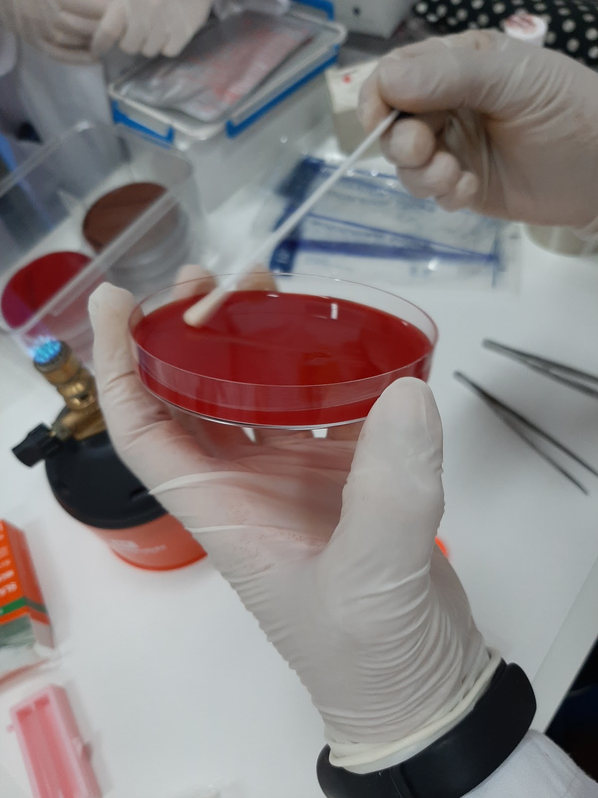 PRACTICA 21: SIEMBRA EN ANAEROBIOSIS