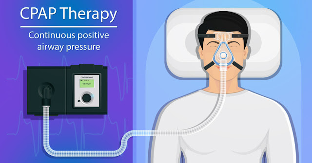 What you should know About Continuous Positive Airway Pressure (CPAP ...