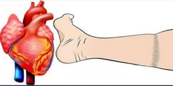 4 Major Heart Attack Red Flags You NEED To Know!