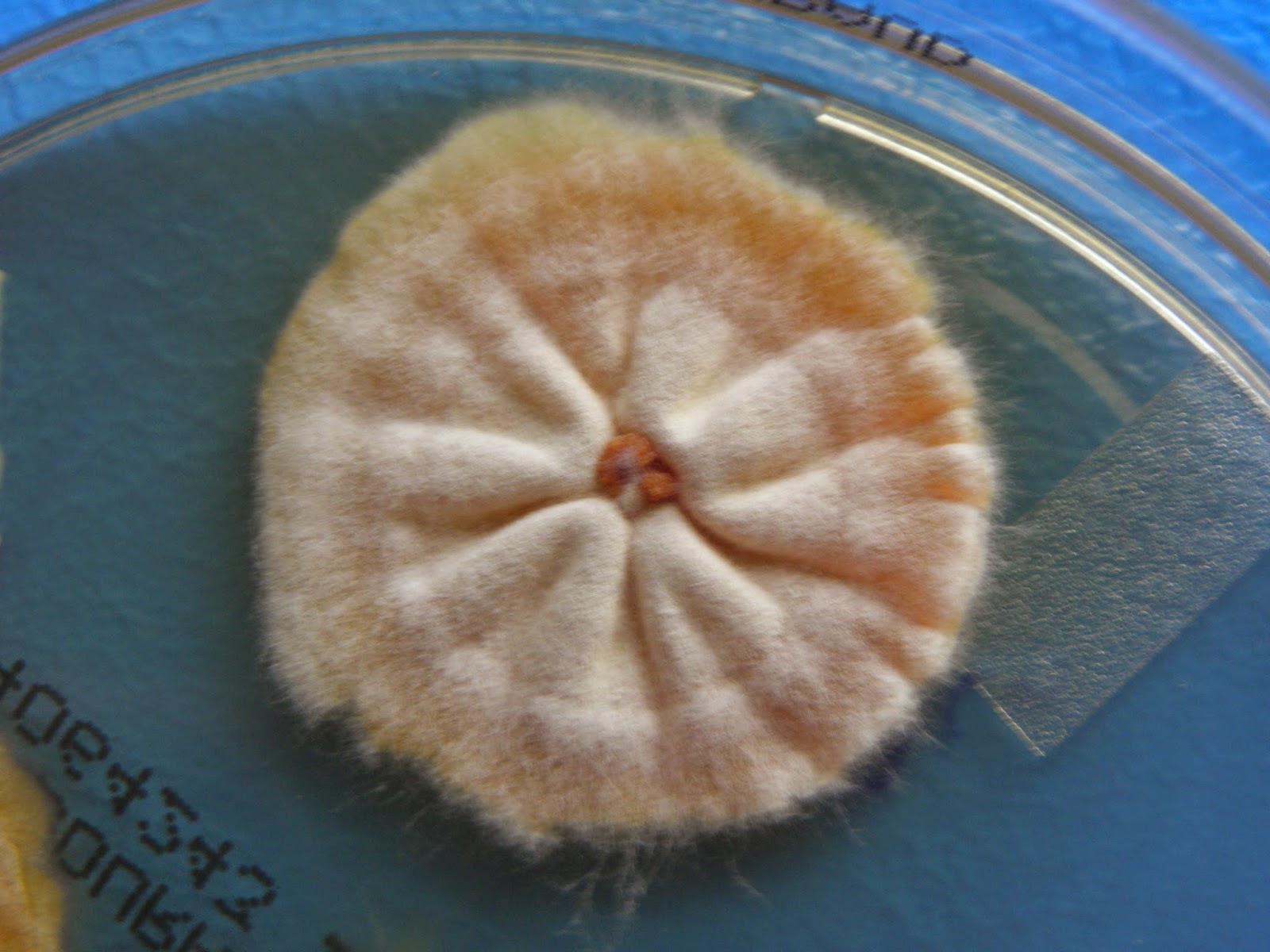 ATLAS MICOLOGIA: TRICHOPHYTON TONSURANS (2)