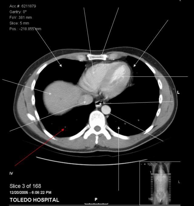 Michael's MRI Study Page: SECTIONAL ANATOMY