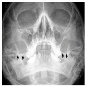 Tema 4. Protocolos radiográficos de cara