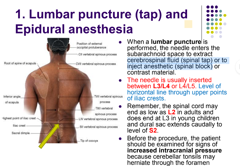 IR( interventional radiology)-8