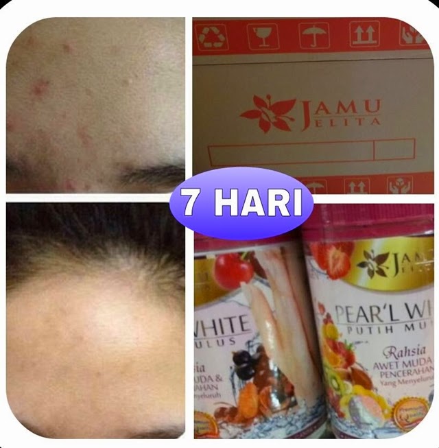 Review Pearl White Jamu Jelita - ! Love Is Cinta