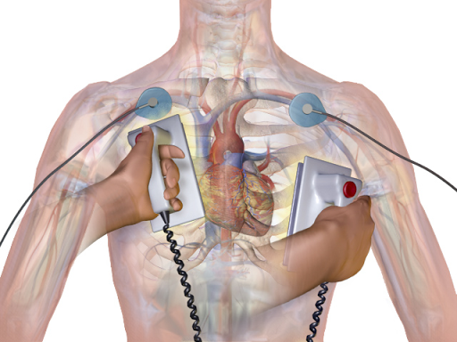 DEFIBRILLATOR - PART 1