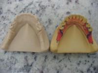 Protese Dentária: PPR - Passo a Passo - Onde chegaremos!!!