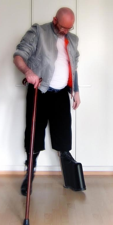 Legbry: Short leg and built-up with kafos