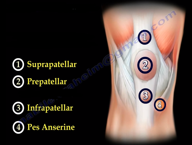 Dr. Nabil Ebraheim's Blogspot: Pes Anserine Bursitis