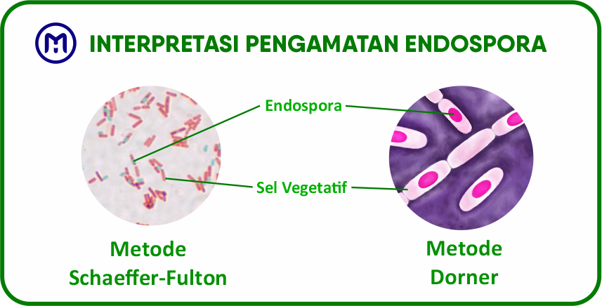 Pewarnaan Endospora - Prinsip dan Prosedur Pewarnaan - MicrobeHolic