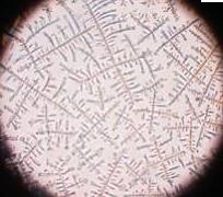 Danielle / Aidan in the Making: Monitoring your Fertility