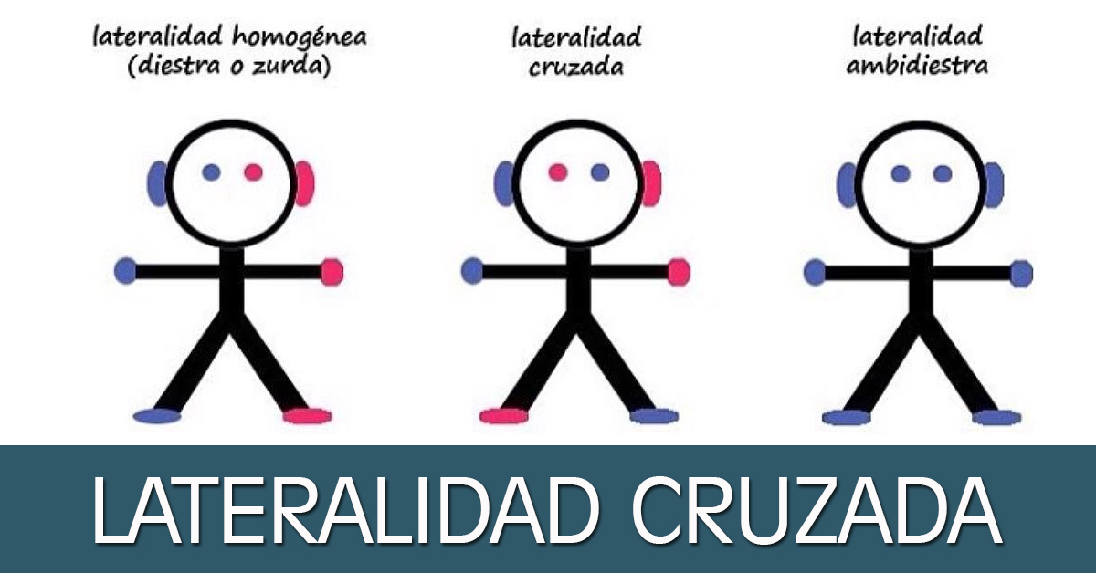 PSICOMOTRICIDAD : LATERALIZACION