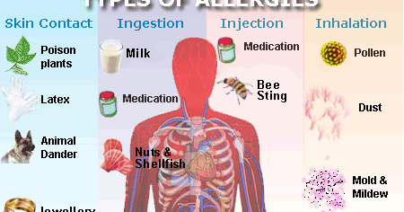 What is Allergy? - Allergy Types