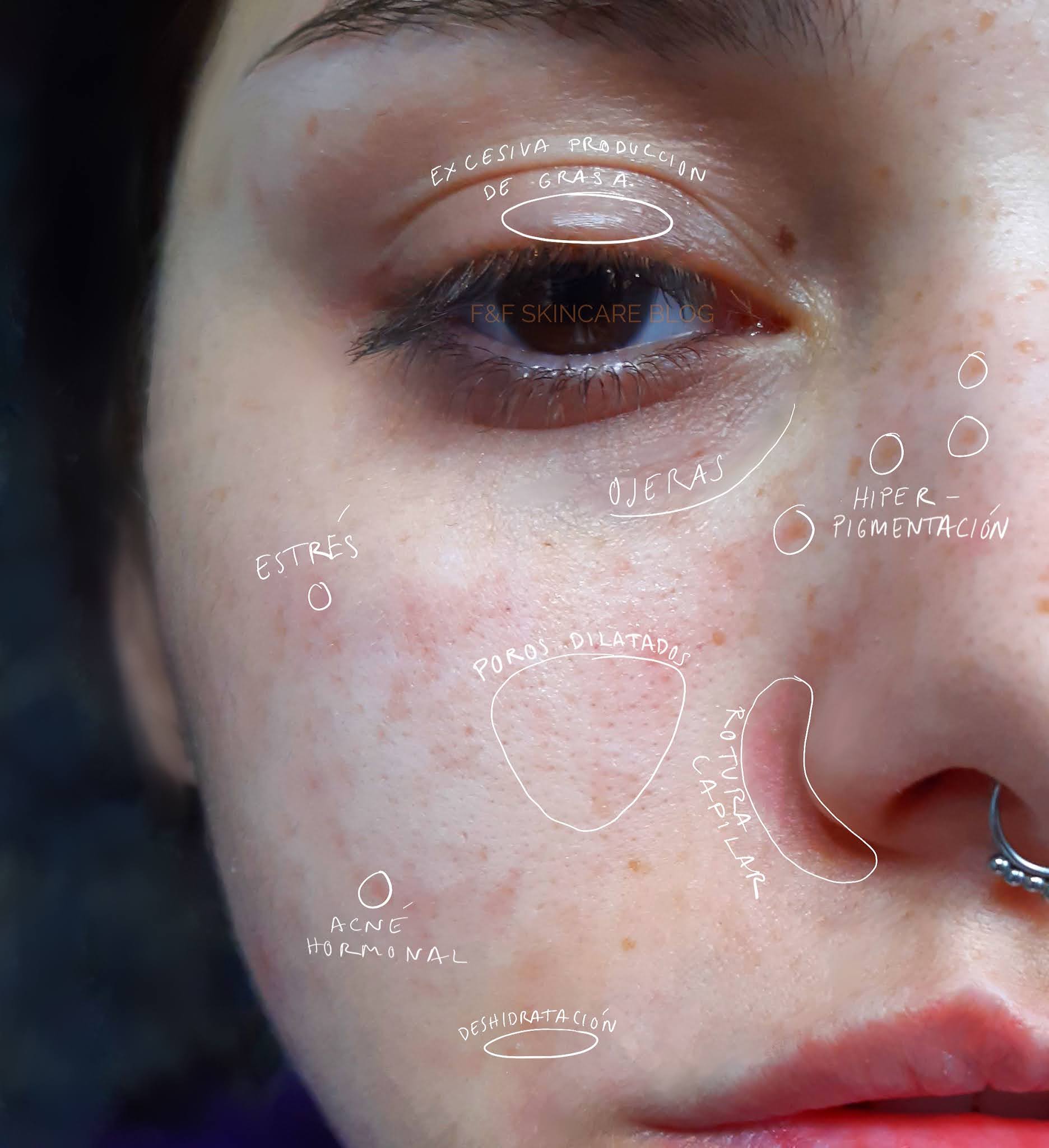 Skin positive: el movimiento que trata de reconciliarte con tu piel
