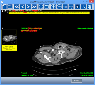 DICOM is Easy: Sneak Peek into DICOMIZER 2.0.5 DICOM Viewer