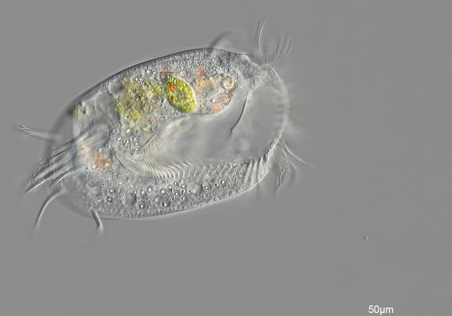 明石・神戸の虫 ときどきプランクトン2: ユープロテス Euplotes sp.
