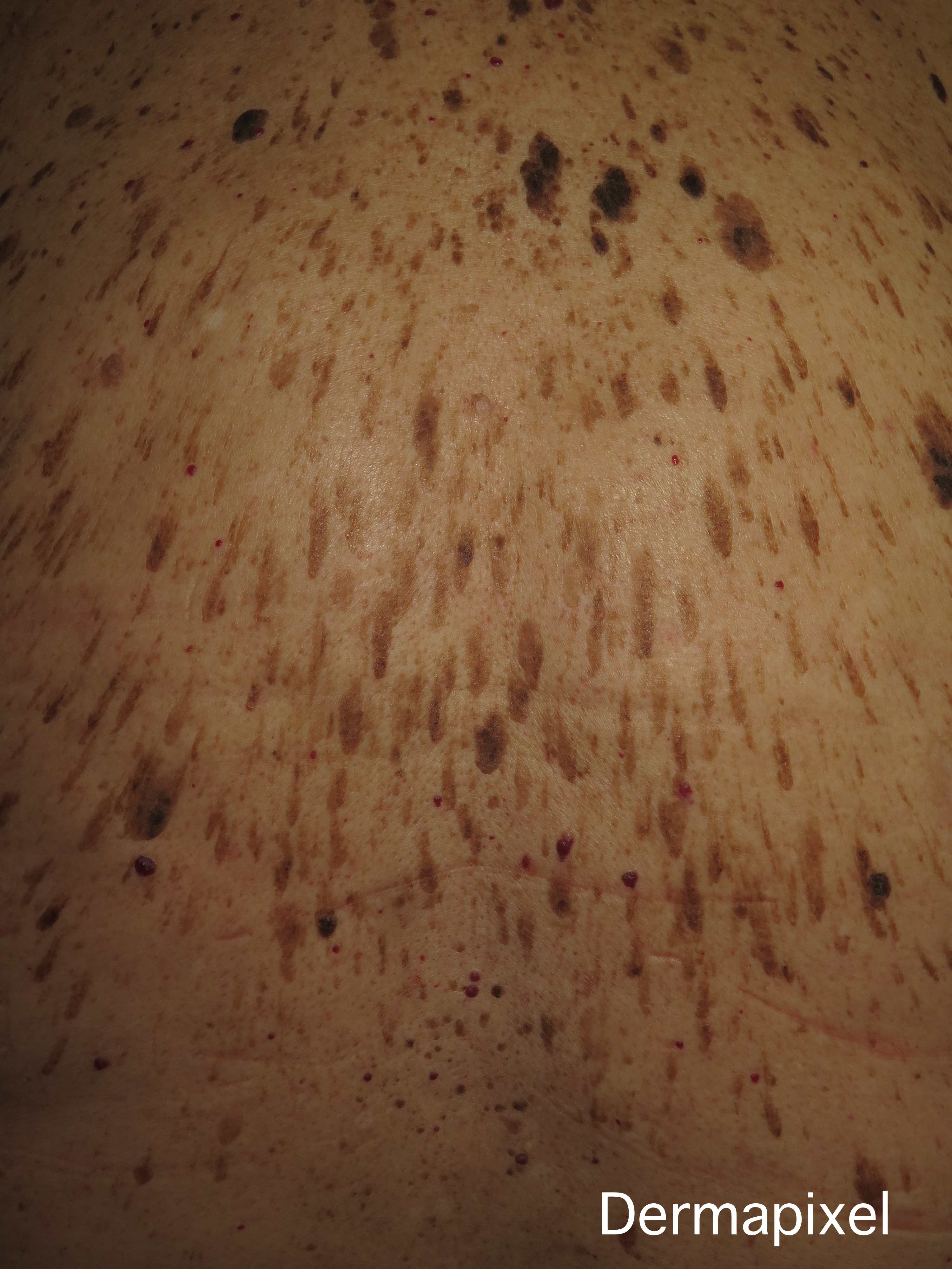 Dermapixel: abril 2021