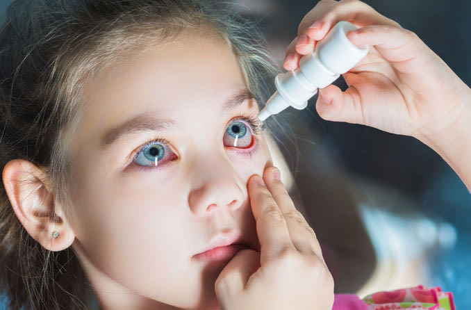 Red eyes in children: causes and treatments