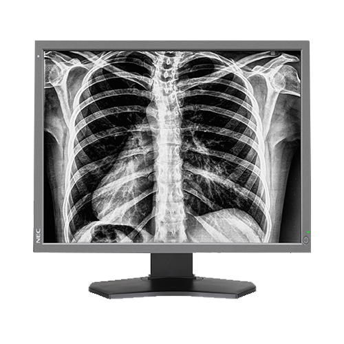 NEC 3MP Grayscale Diagnostic Monitor (FDA cleared) ~ Lumary Birumas