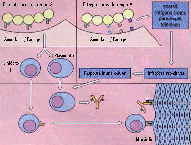 O que é febre reumática - causas e manifestações