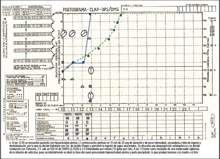 EJEMPLO DE UN PARTOGRAMA