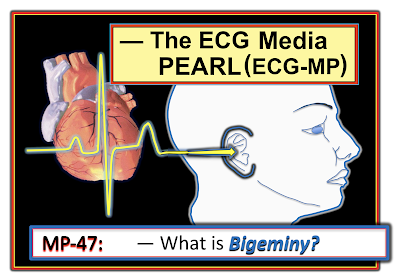 ECG Interpretation: ECG Blog #232 (47) — What is Bigeminy?