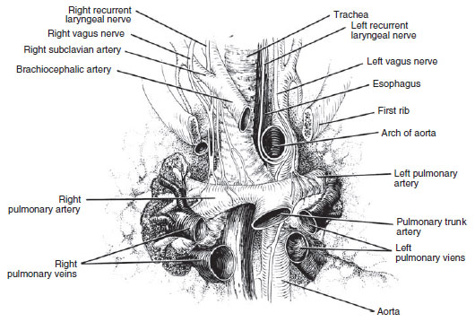 Pulmonary Embolism Case File