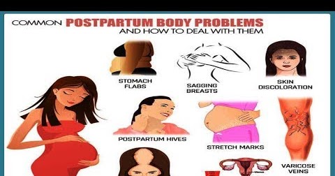 The 8 most common postpartum problems and ways to deal with them