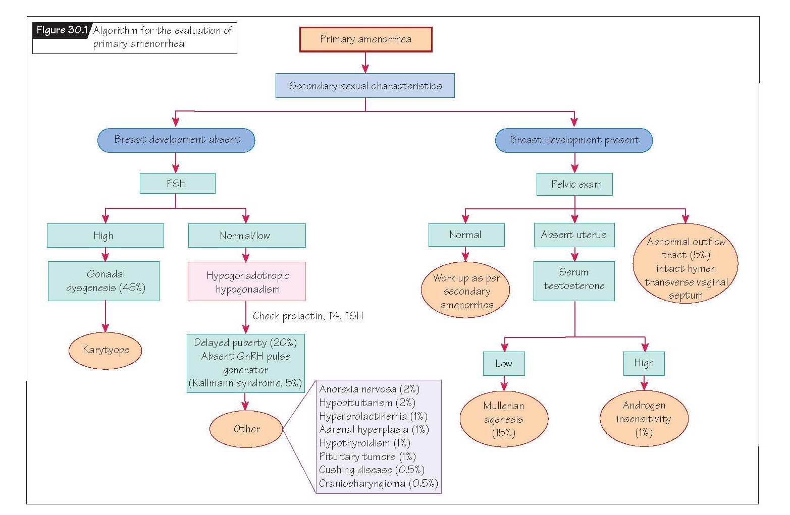 Primary Amenorrhea Algorithm