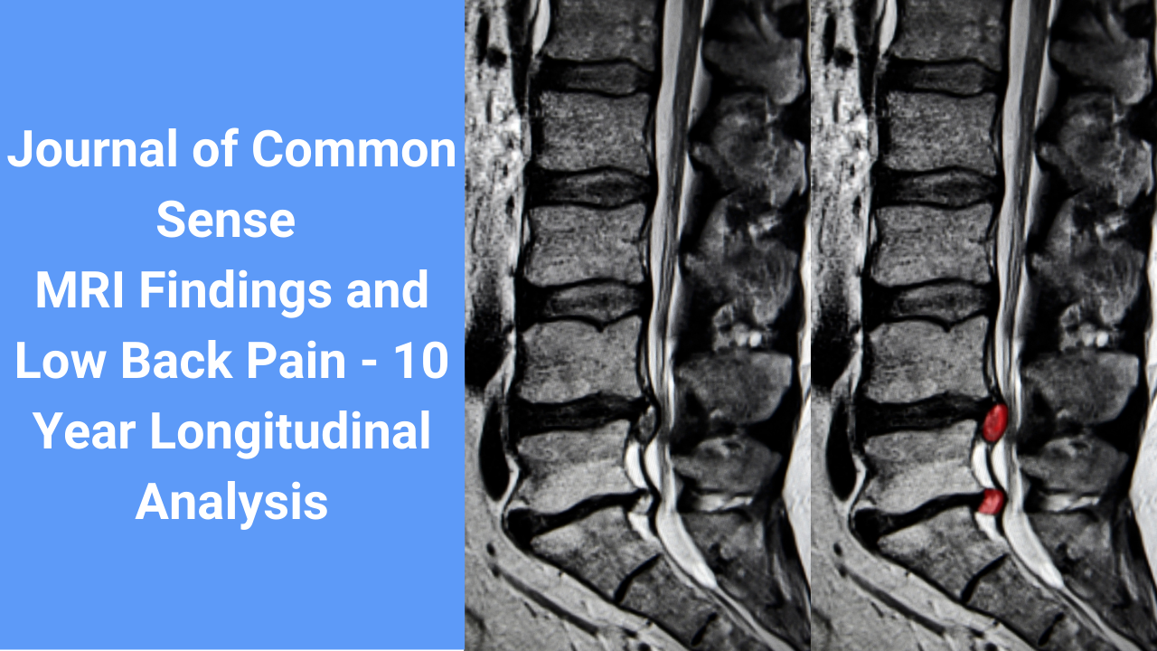 MRI Findings and Low Back Pain - 10 Year Longitudinal Analysis | Modern ...