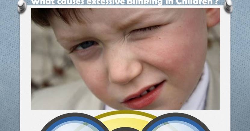 PEDIAMED: What is Blinking ? What causes excessive Blinking in Children ...